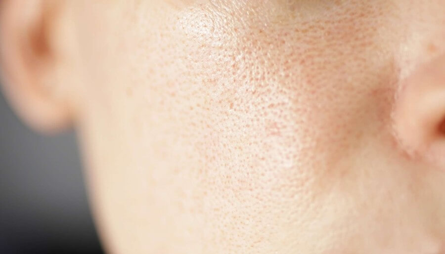 6 Tips for Minimizing Your Pores - Reviva Labs