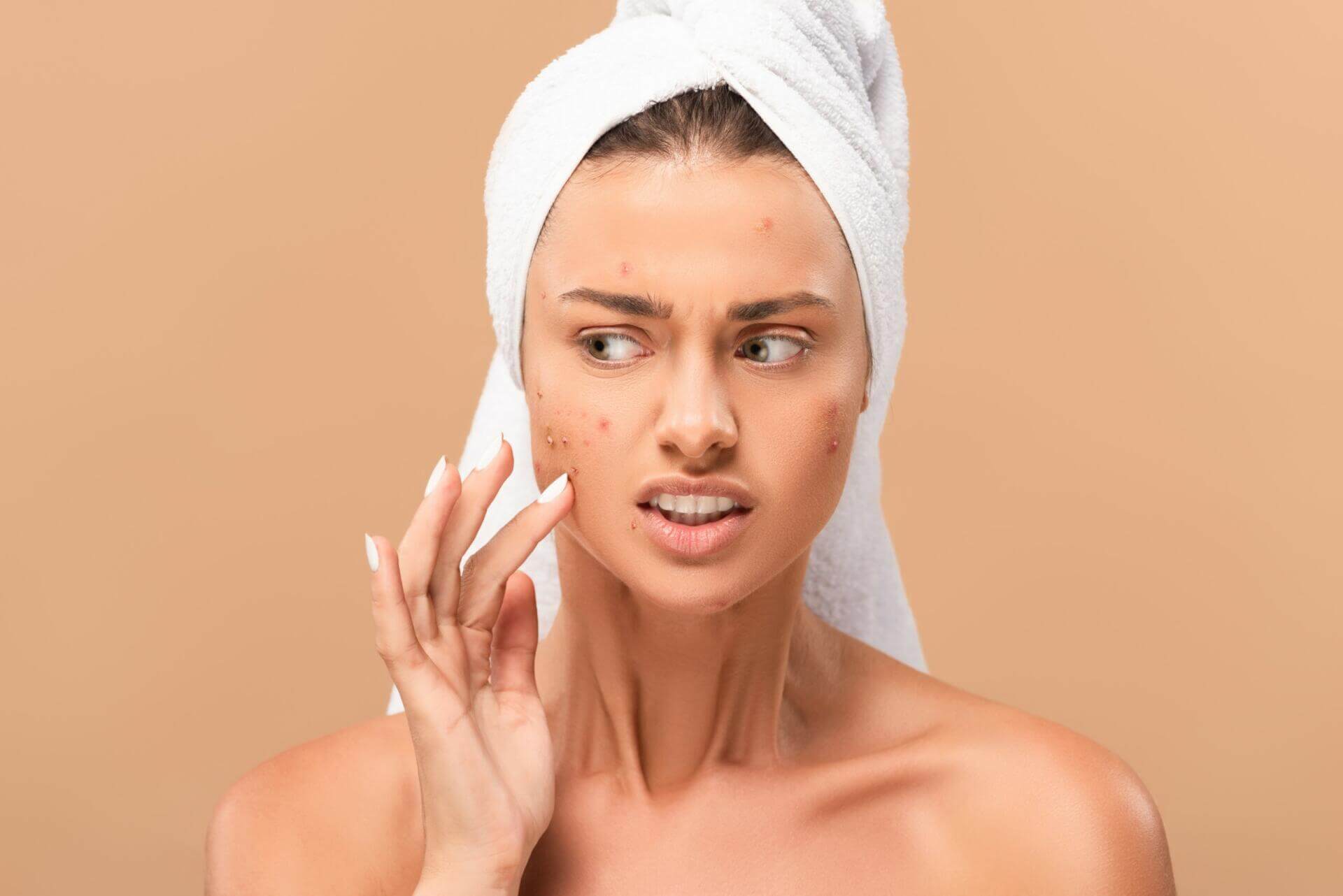 Does Dry Skin Help Acne? - Reviva Labs