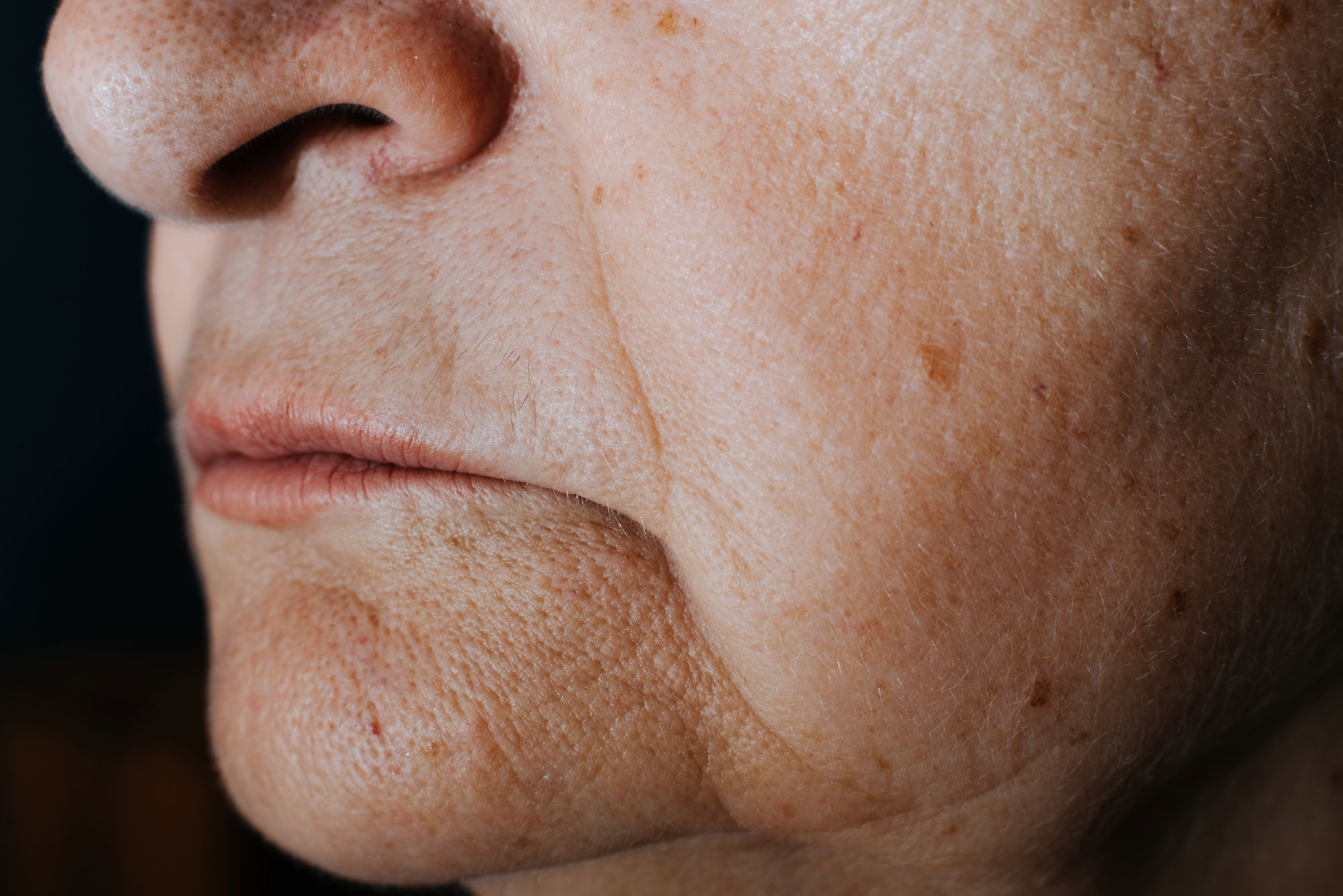 Revitalize Sagging Skin with Top Firming Ingredients!