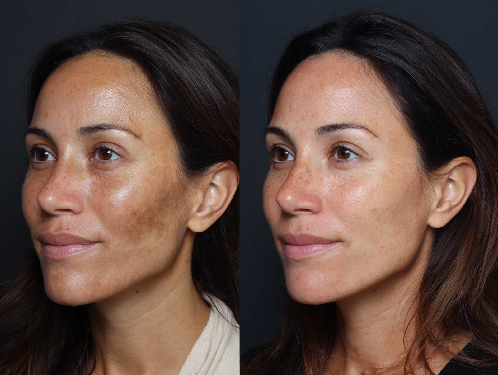 Brighten Dark Spots: Smart Skincare Plan for Even Tone