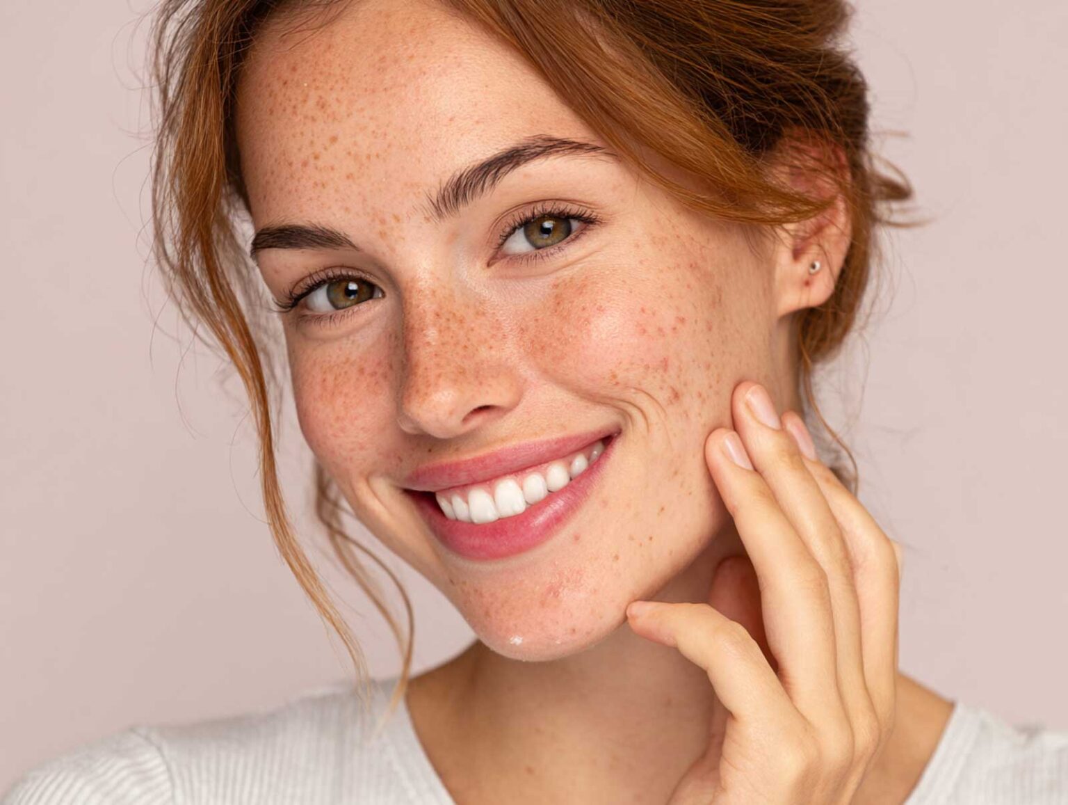 Understanding Cystic Acne: More Than Just Breakouts